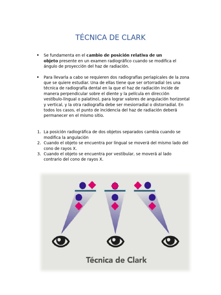 Técnica de Clark | PDF