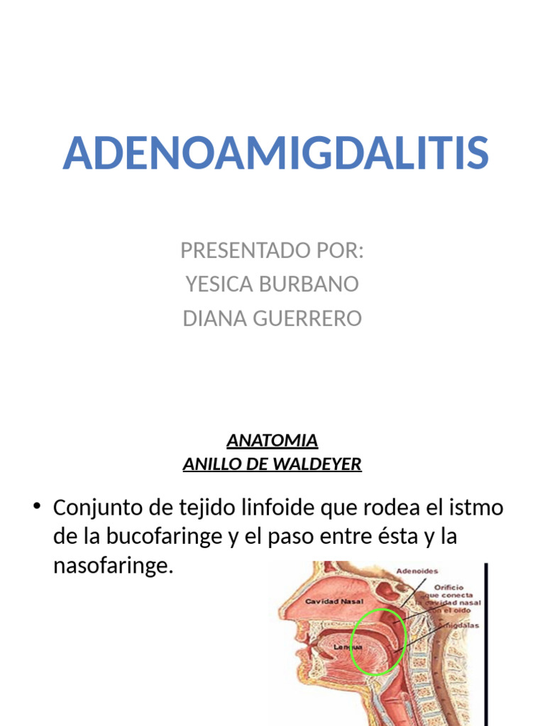 ADENOAMIGDALITIS expo final | PDF | Penicilina | Especialidades Medicas