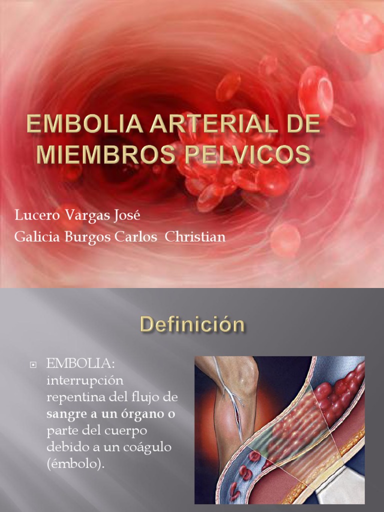 Síntomas y Tratamiento de Embolia Arterial | PDF | Embolia | Trombo
