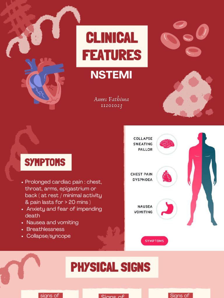 NSTEMI | PDF