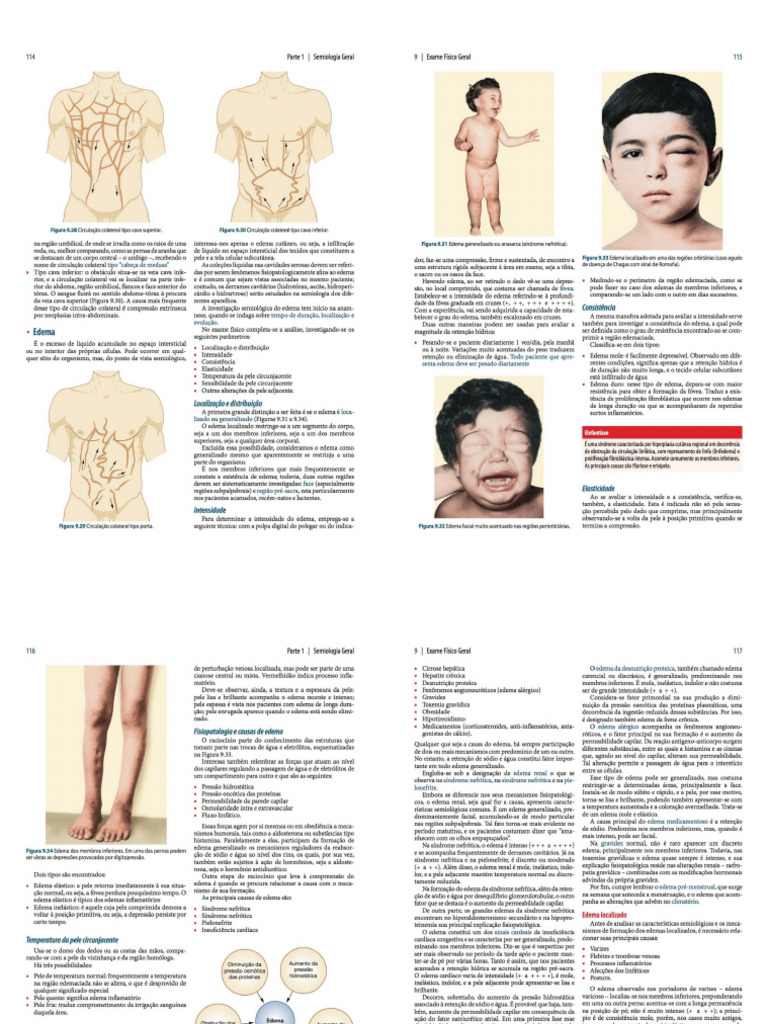 Edema Imprimir | PDF | Edema | Calor