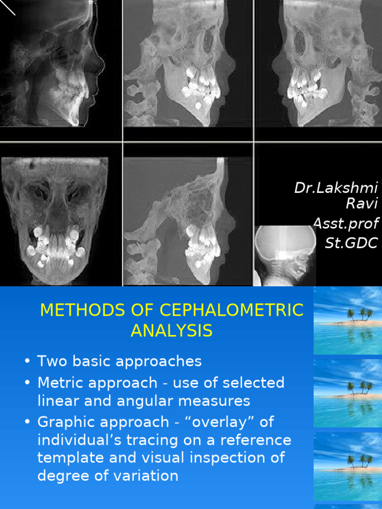 Cephalometric Analysis Methods Explained | PDF | Mouth | Dental Anatomy