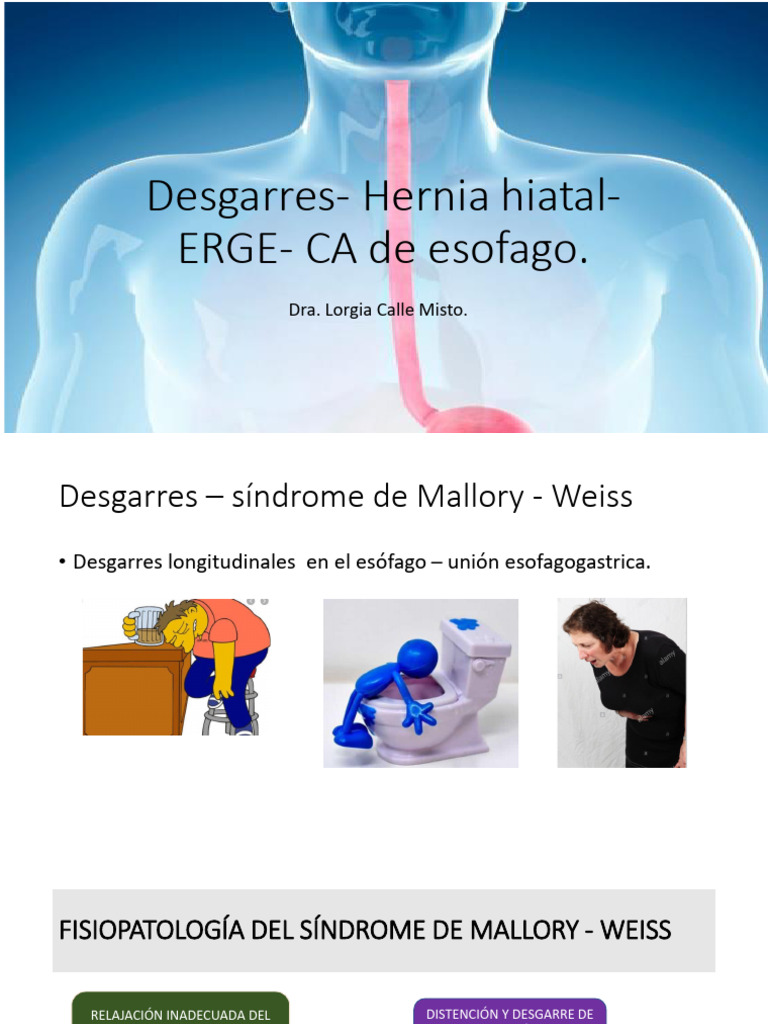 Desgarres - Hernia hiatal-ERGE - CA de Esofago | PDF | La enfermedad ...