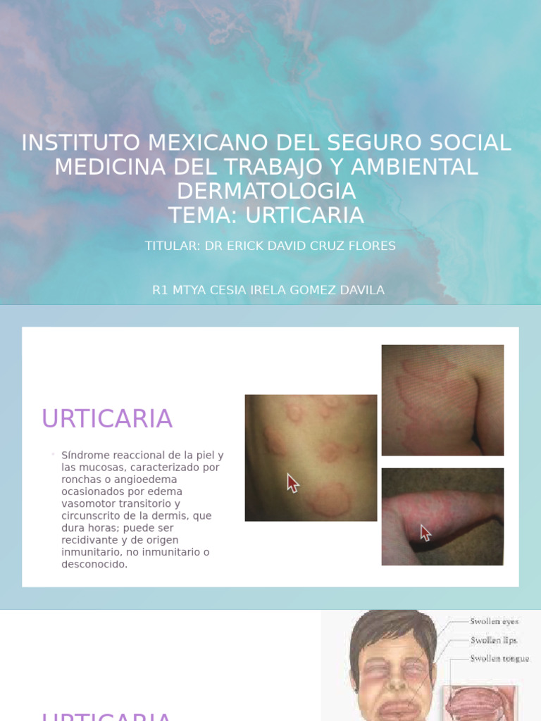 Dermatologia Urticaria | PDF | Alergia | Edema