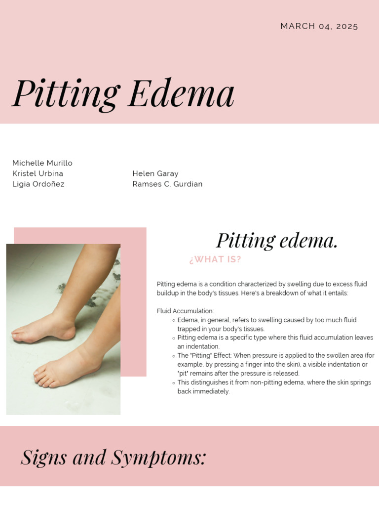 Pitting Edema - 20250304 - 091746 - 0000 | PDF | Edema | Heart Failure