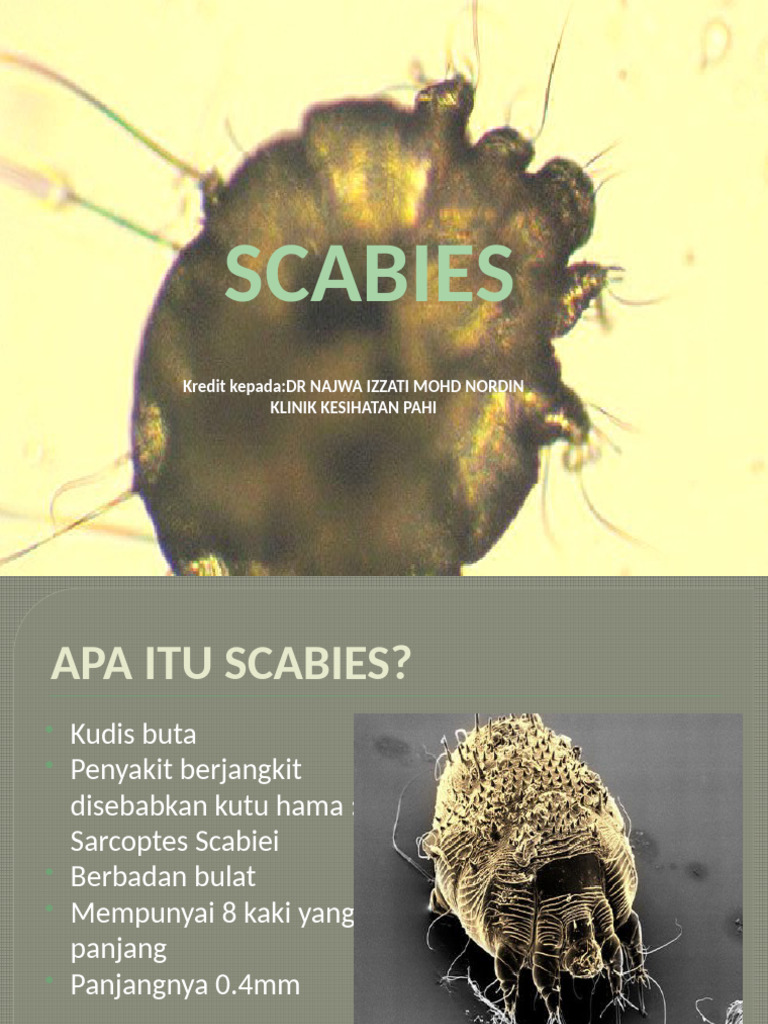 Panduan Lengkap Mengenai Scabies | PDF