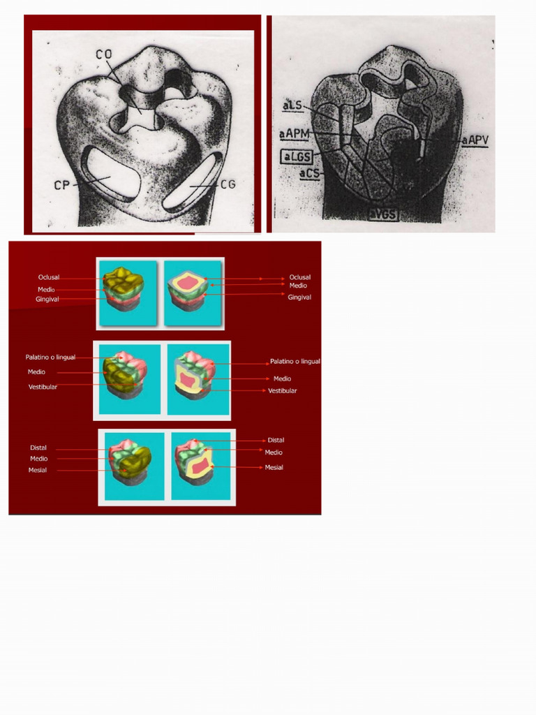 Paredes Cavidades Angulos - Practica 5 Ope | PDF