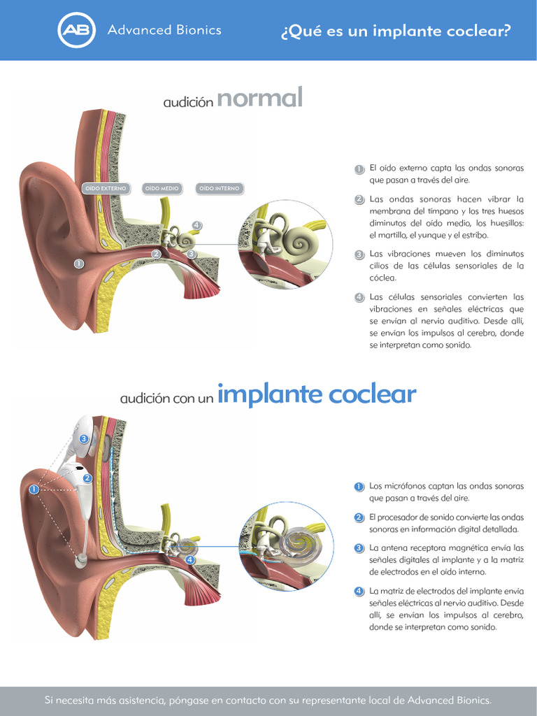 Audición Ic Clinical Tools | PDF | Escuchando | Órganos sensoriales