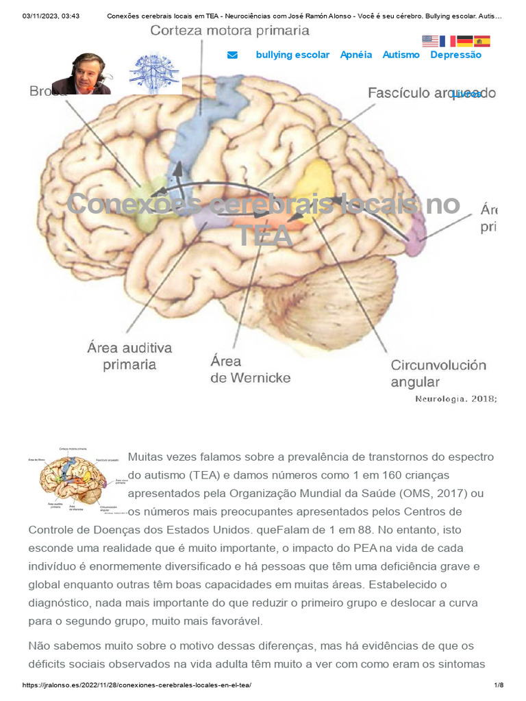 Conectividade Cerebral no TEA | PDF | Autismo | Cérebro