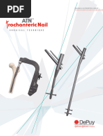 DHS DCS Hip System Surgical Technique | PDF | Hip | Screw