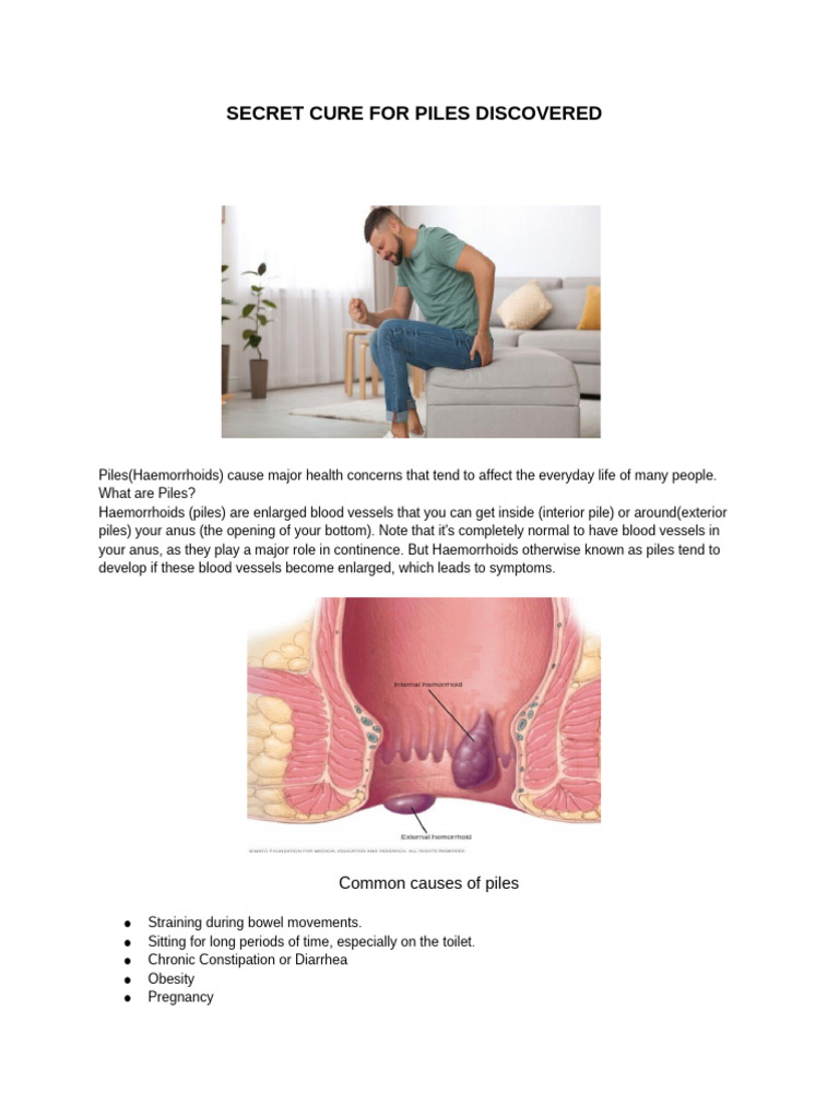 Effective Irish Potato Remedy for Piles | PDF | Hemorrhoid ...