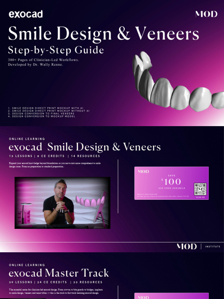 Exocad Smile Design Veneers Step by Step Guide 1 | PDF | 3 D Printing ...