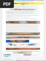 Hipostenuria, Hiperstenuria e Isostenuria | PDF | Bem-estar | Religião ...