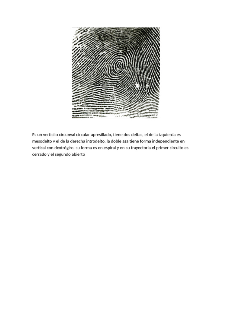 Verticilo Circunval Circular en Espiral | PDF