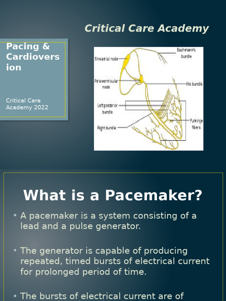 Pacing & Cardioversion | PDF | Artificial Cardiac Pacemaker ...