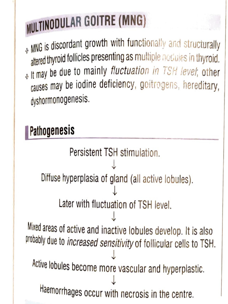 Multinodular Goitre Pathogenesis | PDF