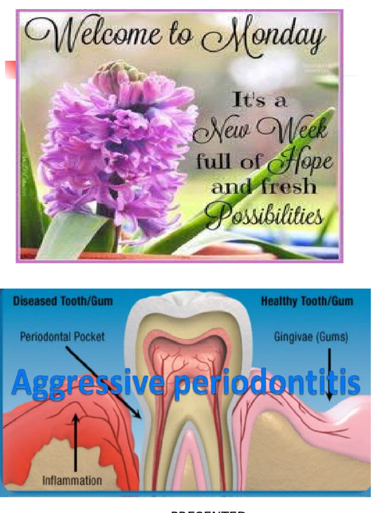 Aggressive Periodontitis | PDF | Periodontology | Dentistry Branches