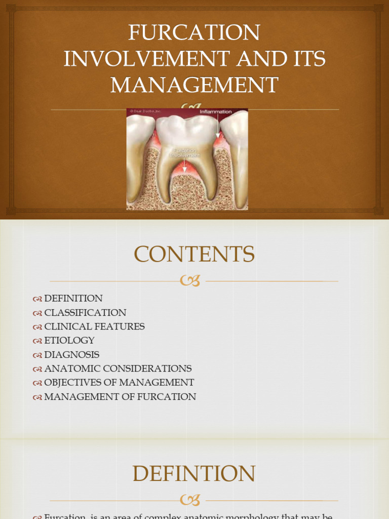 Furcation Involvement Management Guide | PDF | Periodontology | Mouth