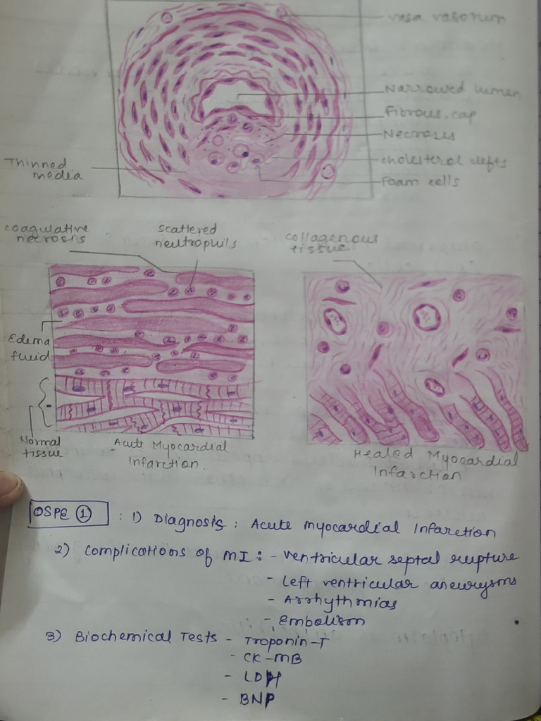 CVS and GIT Patho Journal | PDF