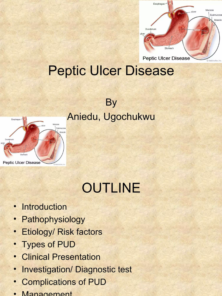 Peptic Ulcer Diseases | PDF