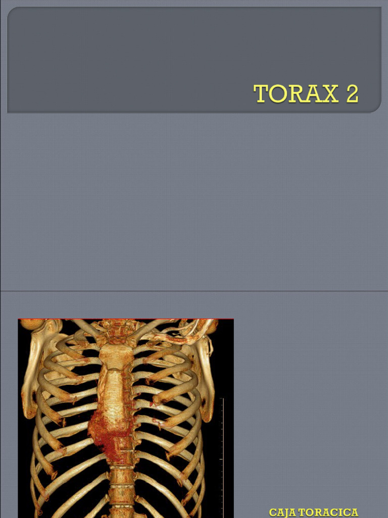 Anatomia Por Imagenes Torax 2 | PDF