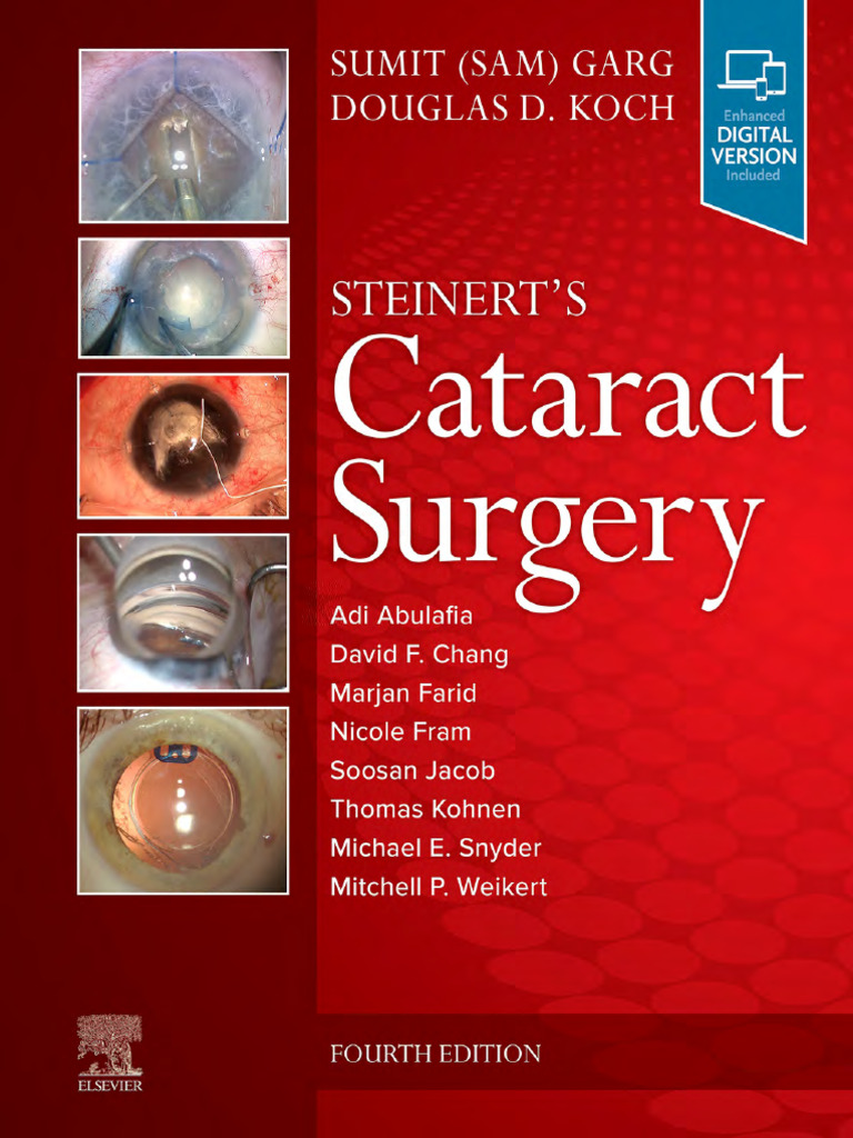 Managing Small Pupil in Cataract Surgery | PDF | Cataract | Eye