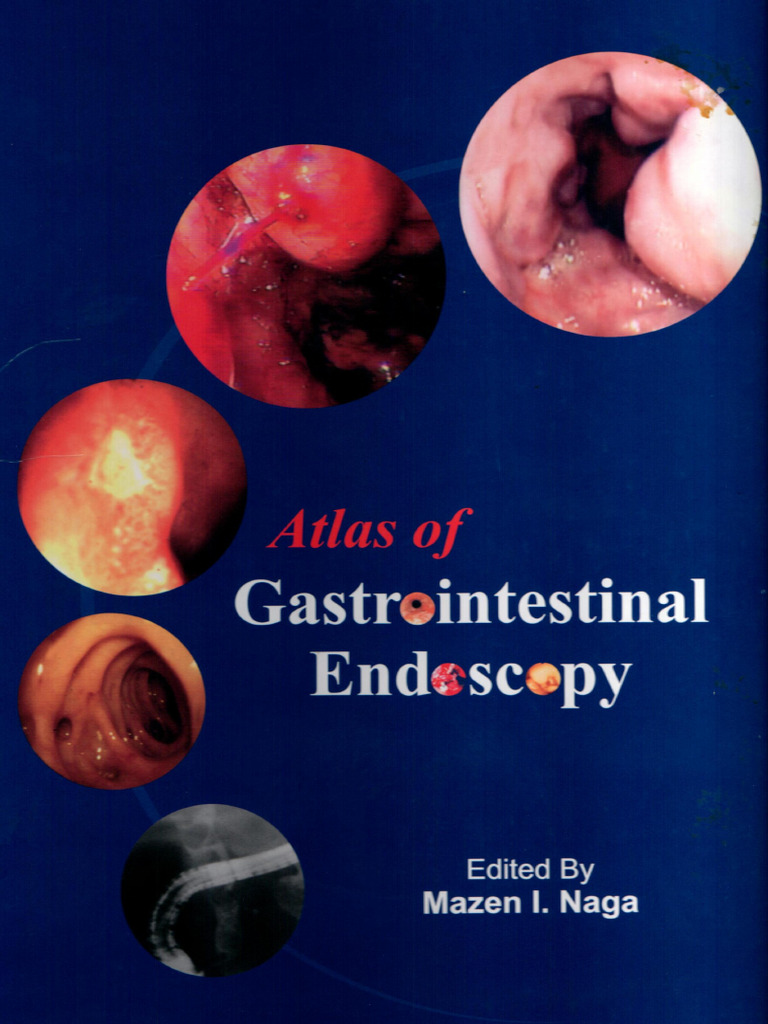 Prof - Mazen Naga Atlas of Gastrointestinal Endoscopy .-1 | PDF ...