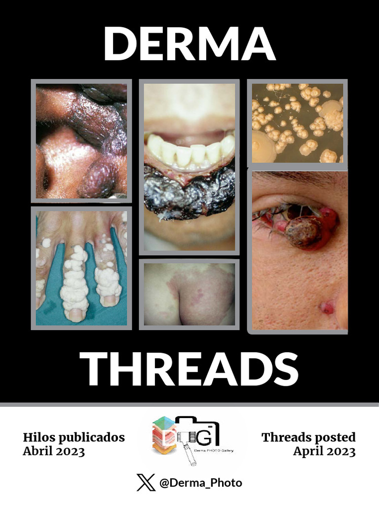 Derma threads Abril | PDF | VIH / SIDA | Infección transmitida sexualmente