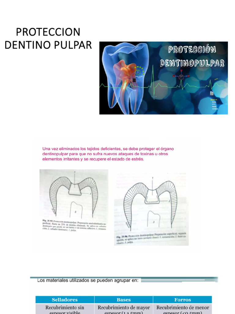 Materiales para Protección Dentinopulpar | PDF | Materiales