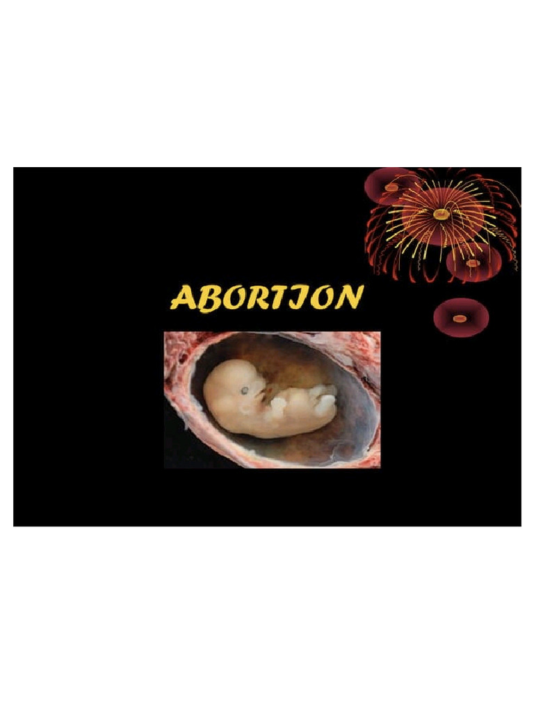 Abortion | PDF