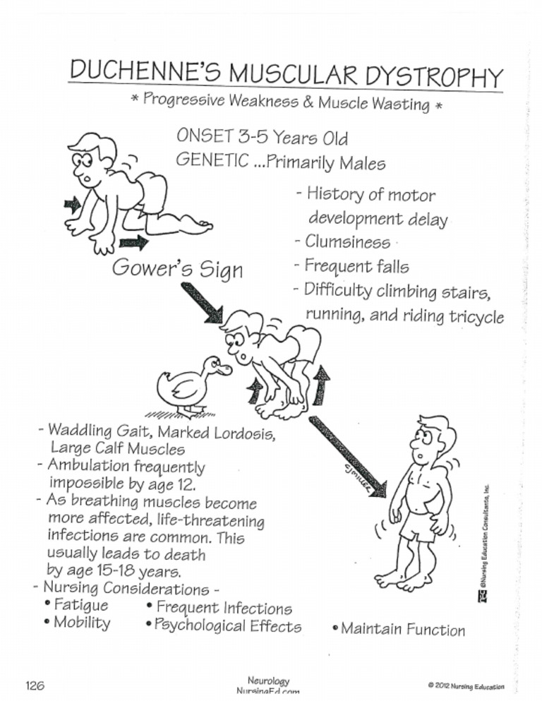 Duchenne's Muscular Dystrophy | PDF