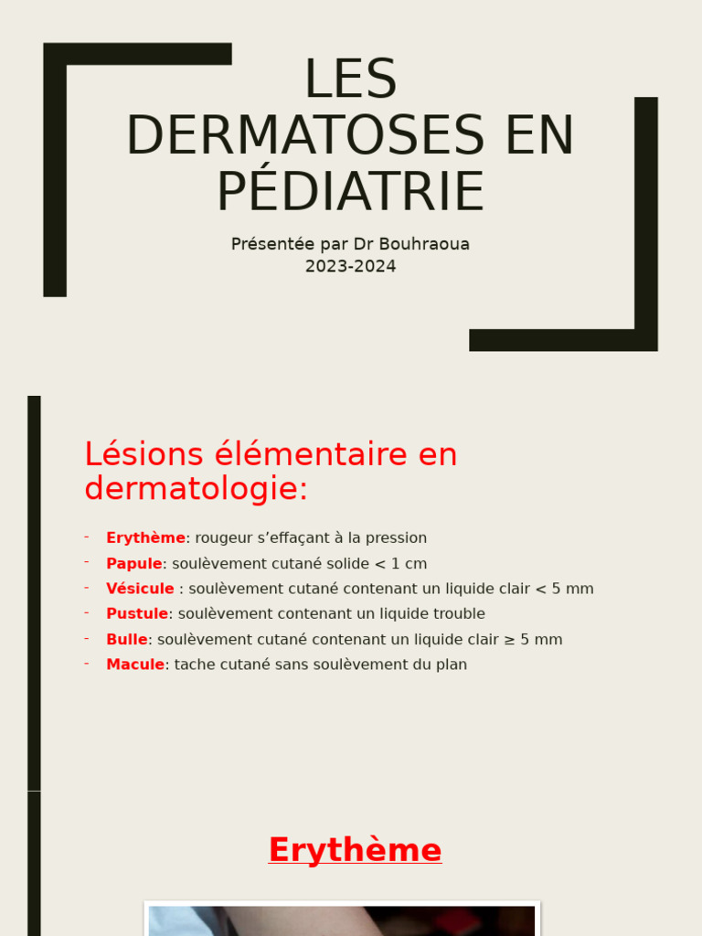 Dermatoses pédiatriques : diagnostic et traitement | PDF | Maladies et ...