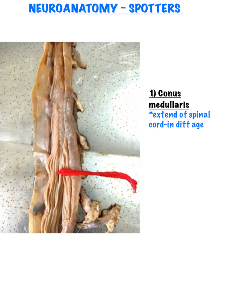 2 Neuroanatomy Spotters | PDF