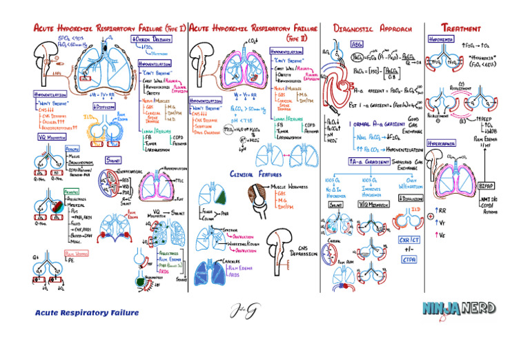 Acute Respiratory Failure Overview | PDF