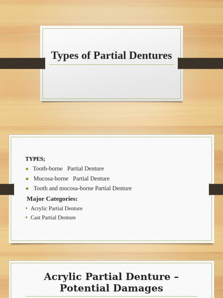 Types of Removable Partial Dentures | PDF | Dentures | Dentistry