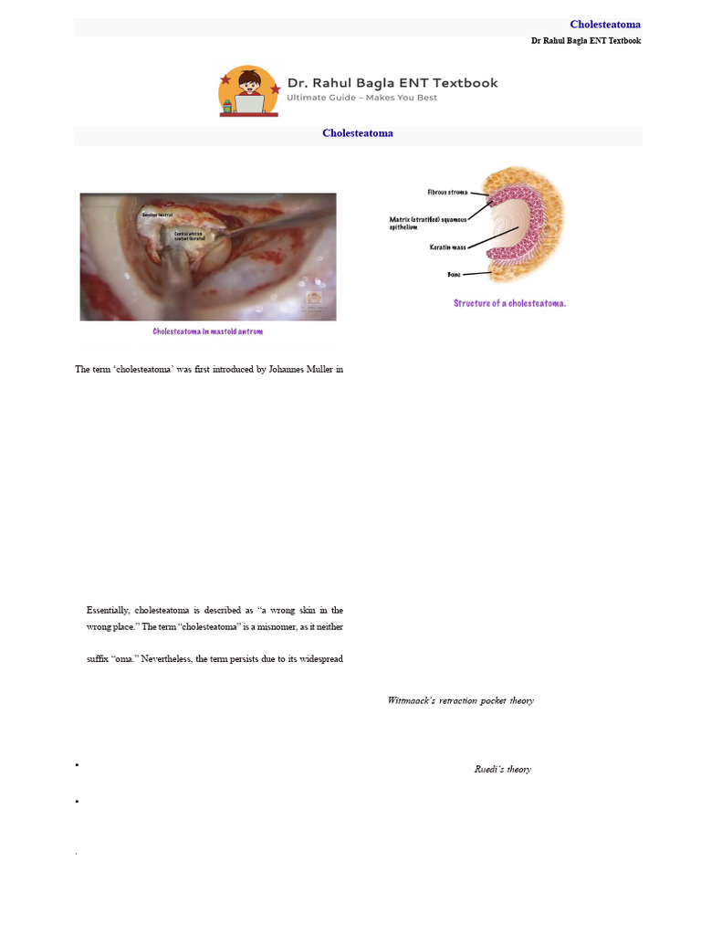 Cholesteatoma-Best-Lecture-Notes-Dr-Rahul-Bagla-ENT-Textbook | PDF ...