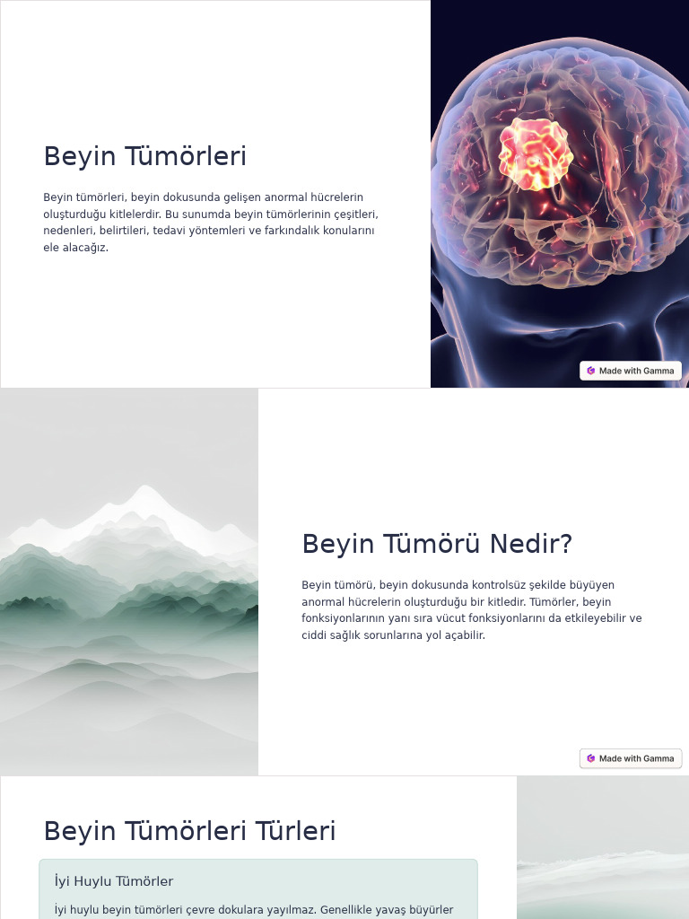 Beyin Tumorleri Mustafa Kasap | PDF