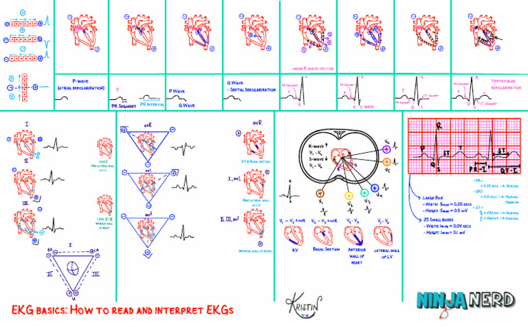 Cardiovascular Physiology) 04 EKG Basics (New) - Key | PDF