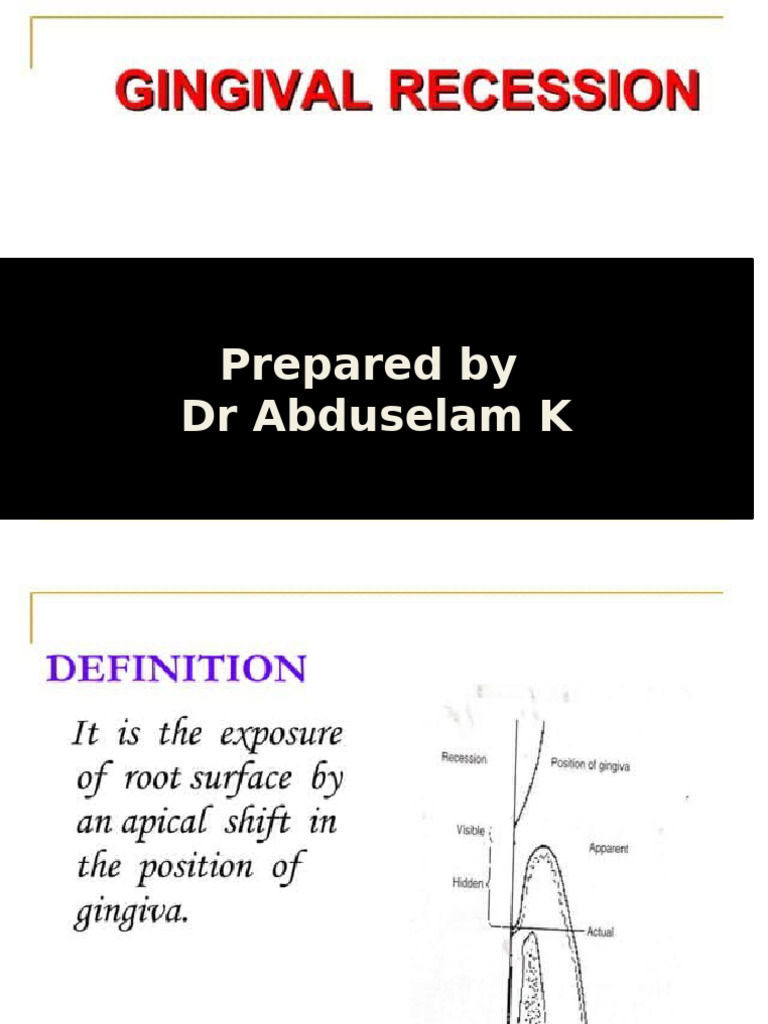 Gingival Recession | PDF