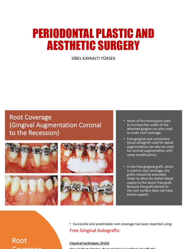 Root Coverage Techniques in Periodontal Surgery | PDF | Periodontology ...