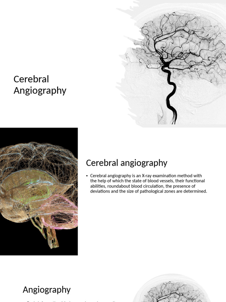 Cerebral Angiography: Procedure Overview | PDF | Angiography | Diseases ...