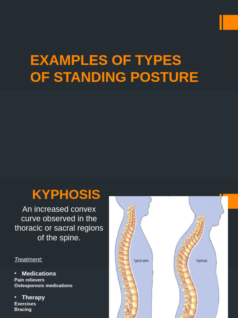 Examples of Types of Standing Posture | PDF | Vertebral Column ...