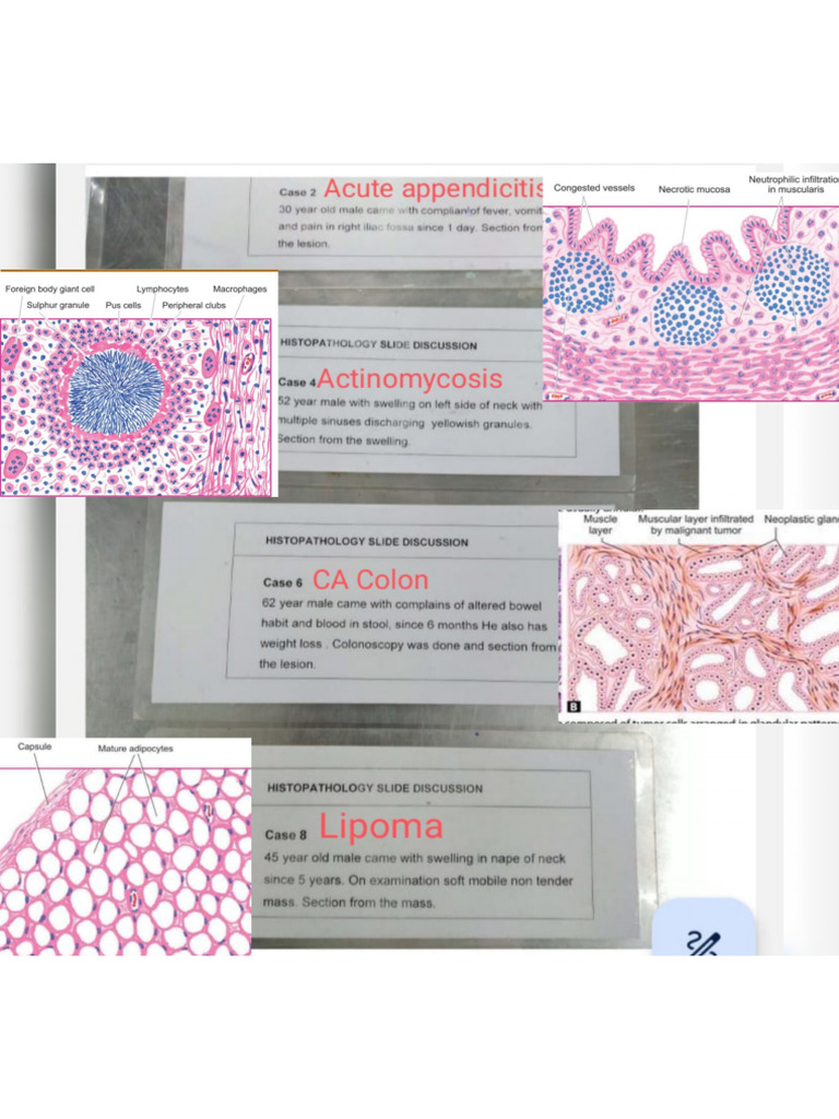 Patho Practical | PDF