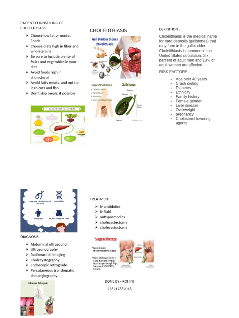 Cholelithiasis Pill | PDF