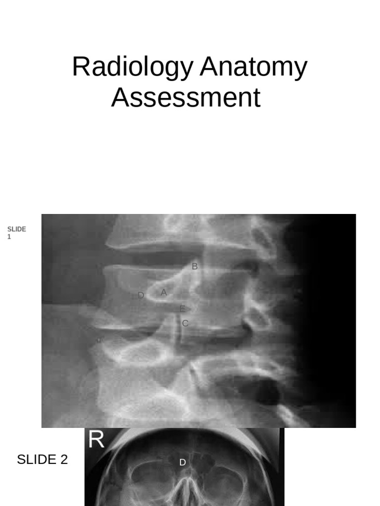 Radiology Anatomy Assessment (1) | PDF