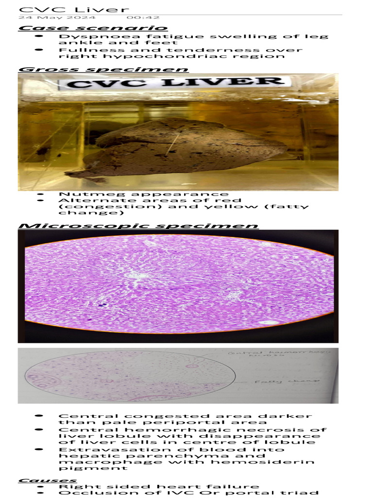 CVC Liver | PDF