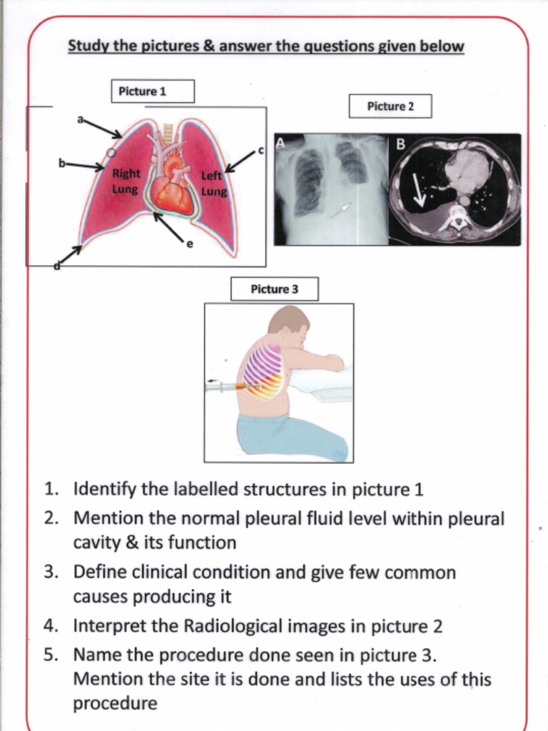 thorax OSPE | PDF
