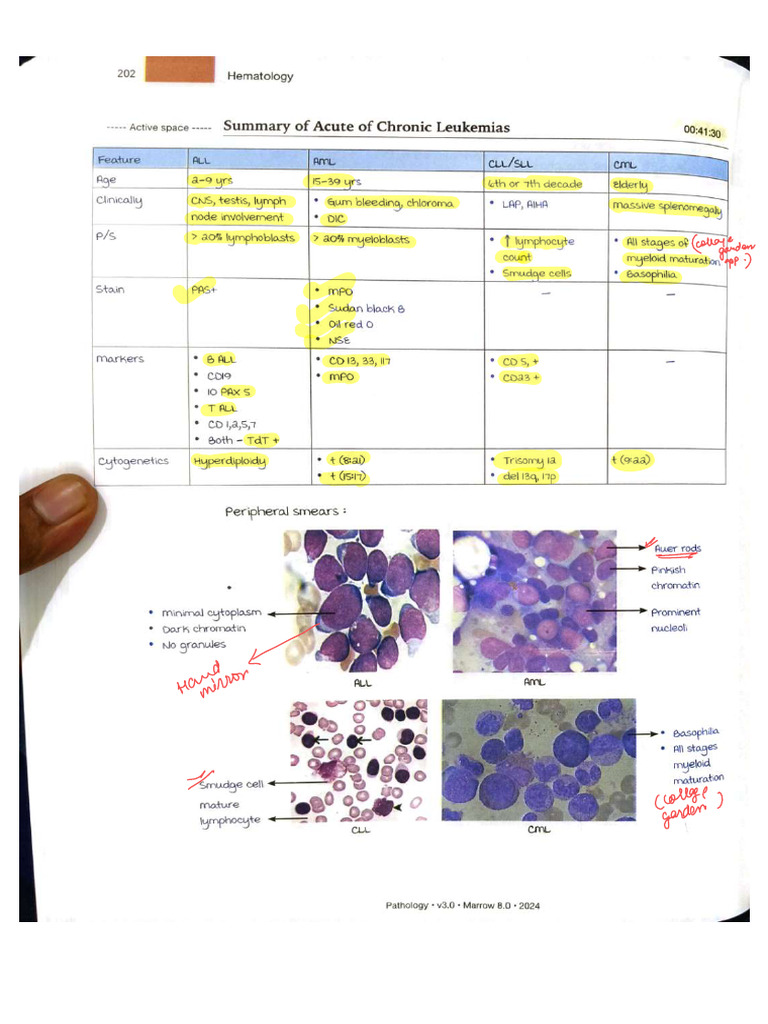 Pathology Marrow E8 (2) | PDF