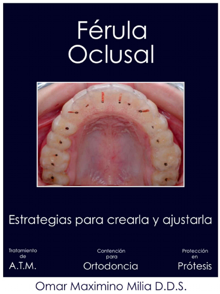 FERULA OCLUSAL - ESTRATEGIAS PAR - Omar Maximino Milia | PDF