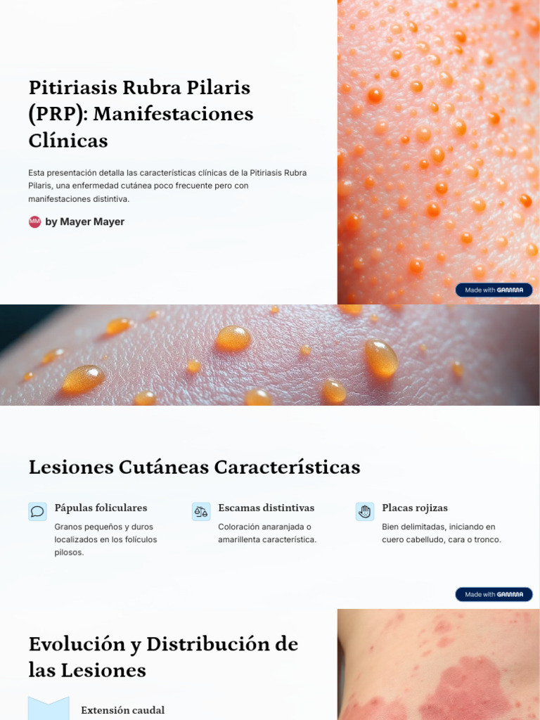 Pitiriasis Rubra Pilaris PRP Manifestaciones Clinicas | PDF